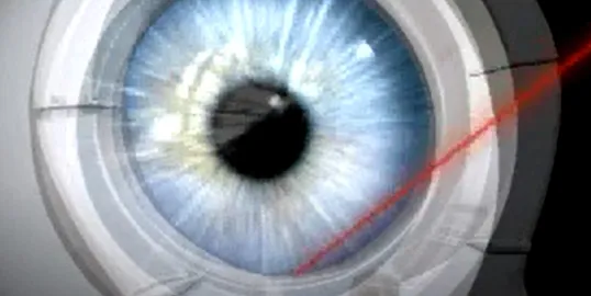 The Eye Foundation- Lasik Treatment & Surgery in India